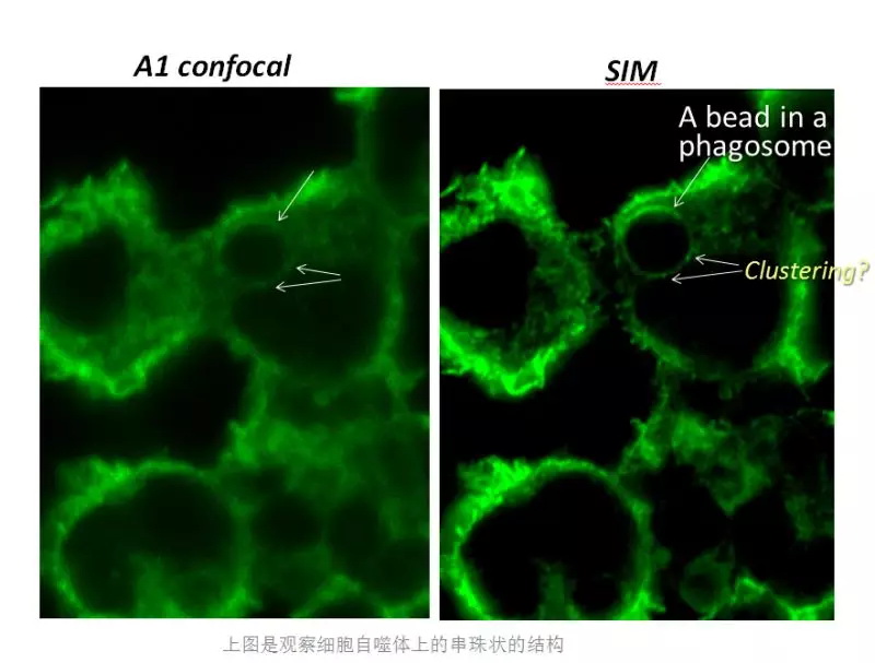 结构光照明显微镜（Structured Illumination Microscopy）——一种简单易操作的超分辨率成像技术-清华大学蛋白质 ...